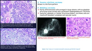 Pathophysiology of breast cancer | PPTX