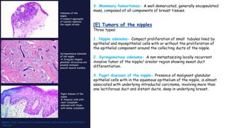 Pathophysiology of breast cancer | PPTX