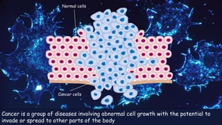 Pathophysiology of breast cancer | PPTX