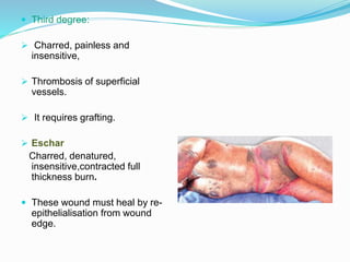 Pathophysiology of burns | PPTX