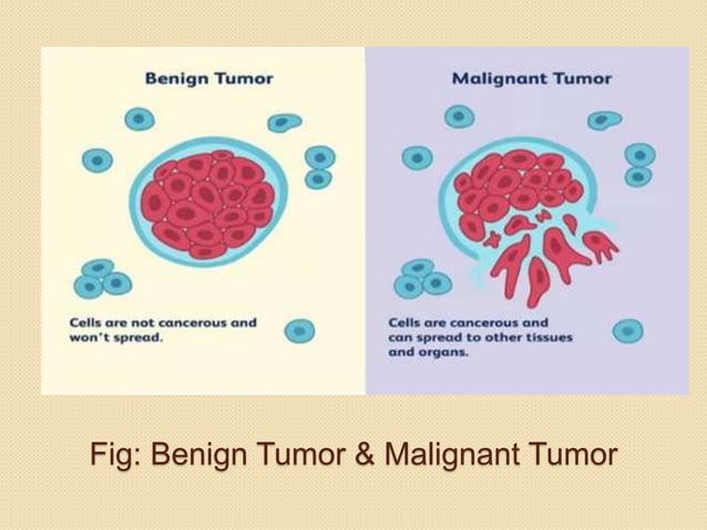 Pathophysiology of cancer | PPTX | Cancer | Diseases and Conditions