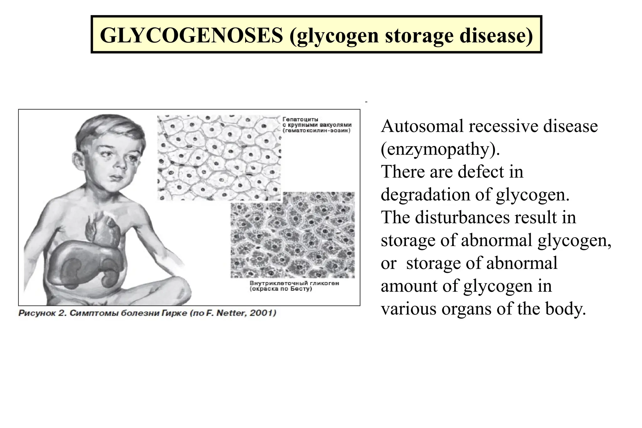 Pathophysiology of carbohydrate metabolism.pdf