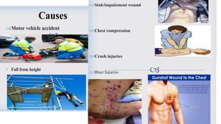 PATHOPHYSIOLOGY MAJOR OF CHEST INJURIES.pptx