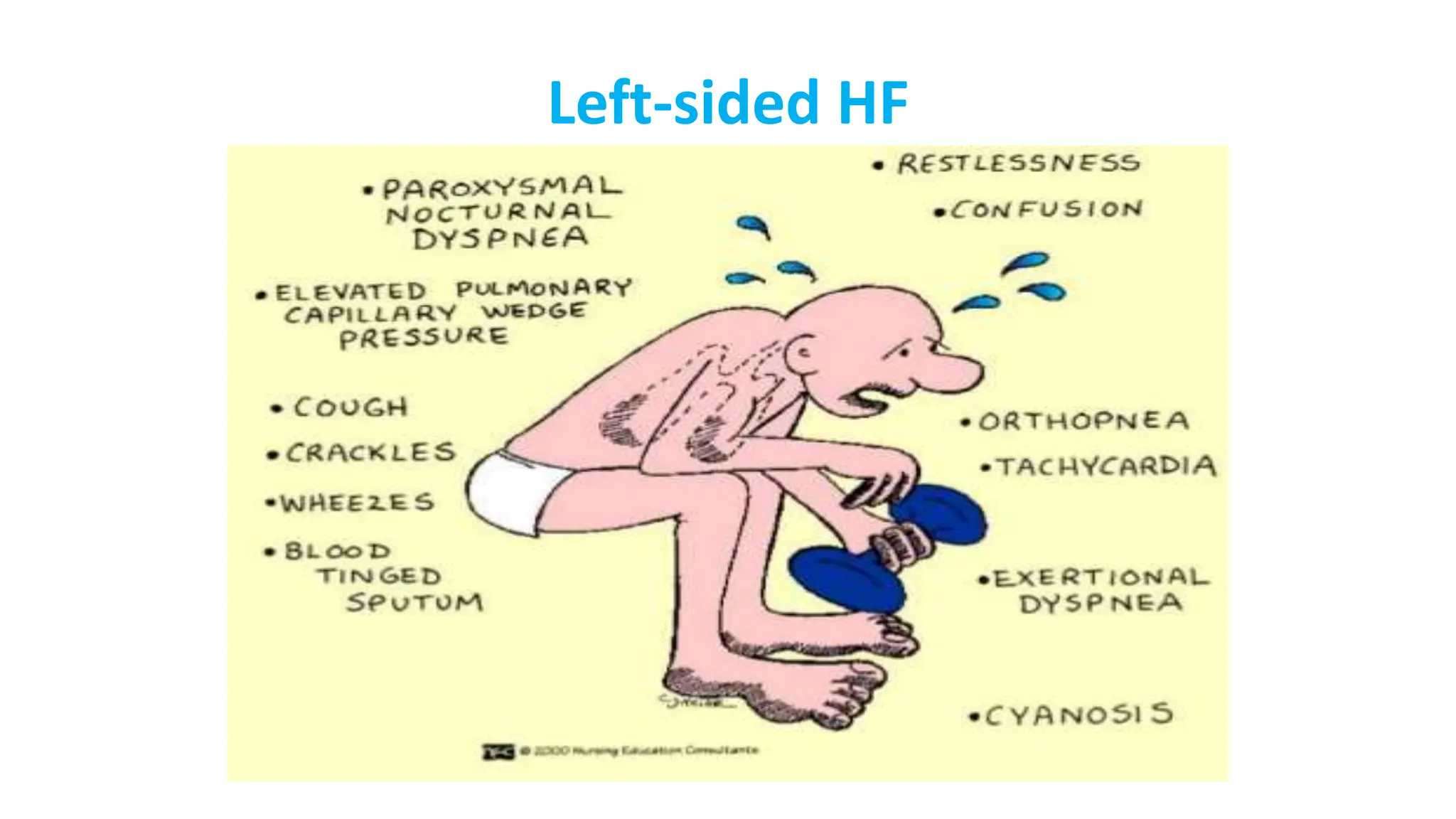 Pathophysiology of CHF PABITRAAAAAAAAppt | PPT