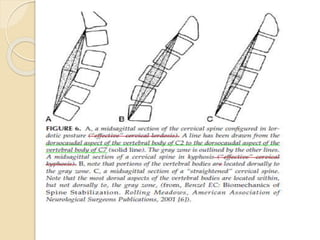 Pathophysiology of csm.pptx
