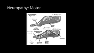 Pathophysiology of DFU.pptx | Diabetes | Diseases and Conditions