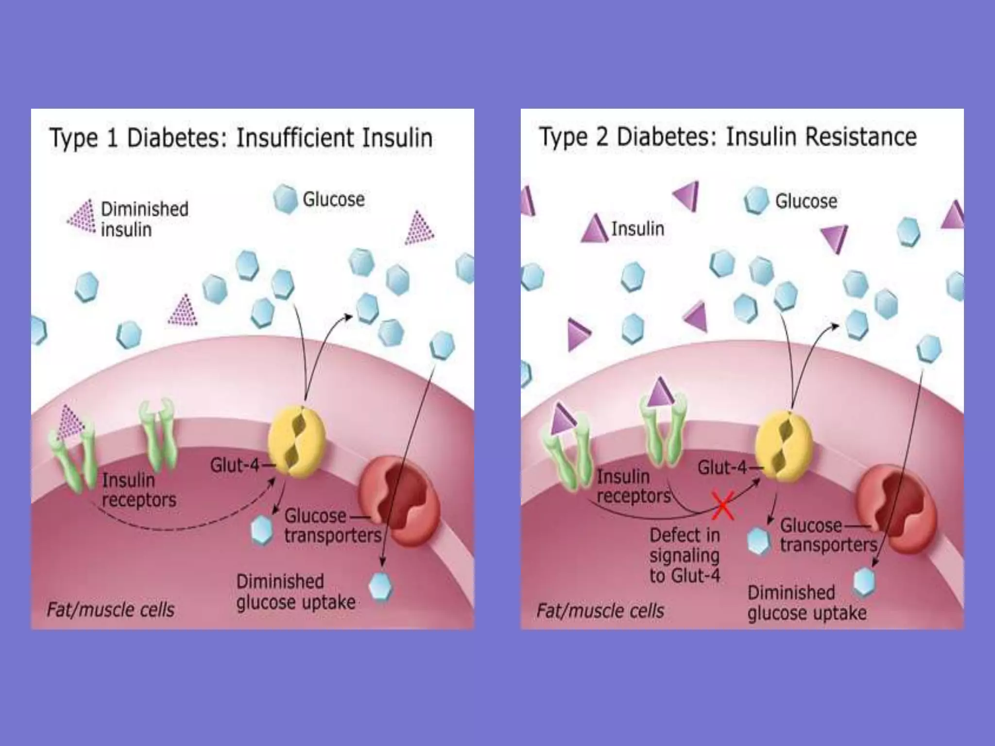 Pathophysiology of diabetes final 2 | PPTX