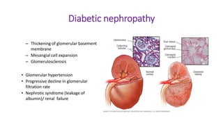 Pathophysiology of diabetes mellitus | PPTX