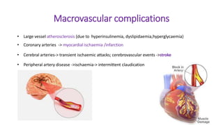 Pathophysiology of diabetes mellitus | PPTX