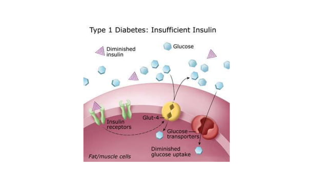Pathophysiology of diabetes mellitus | PPTX