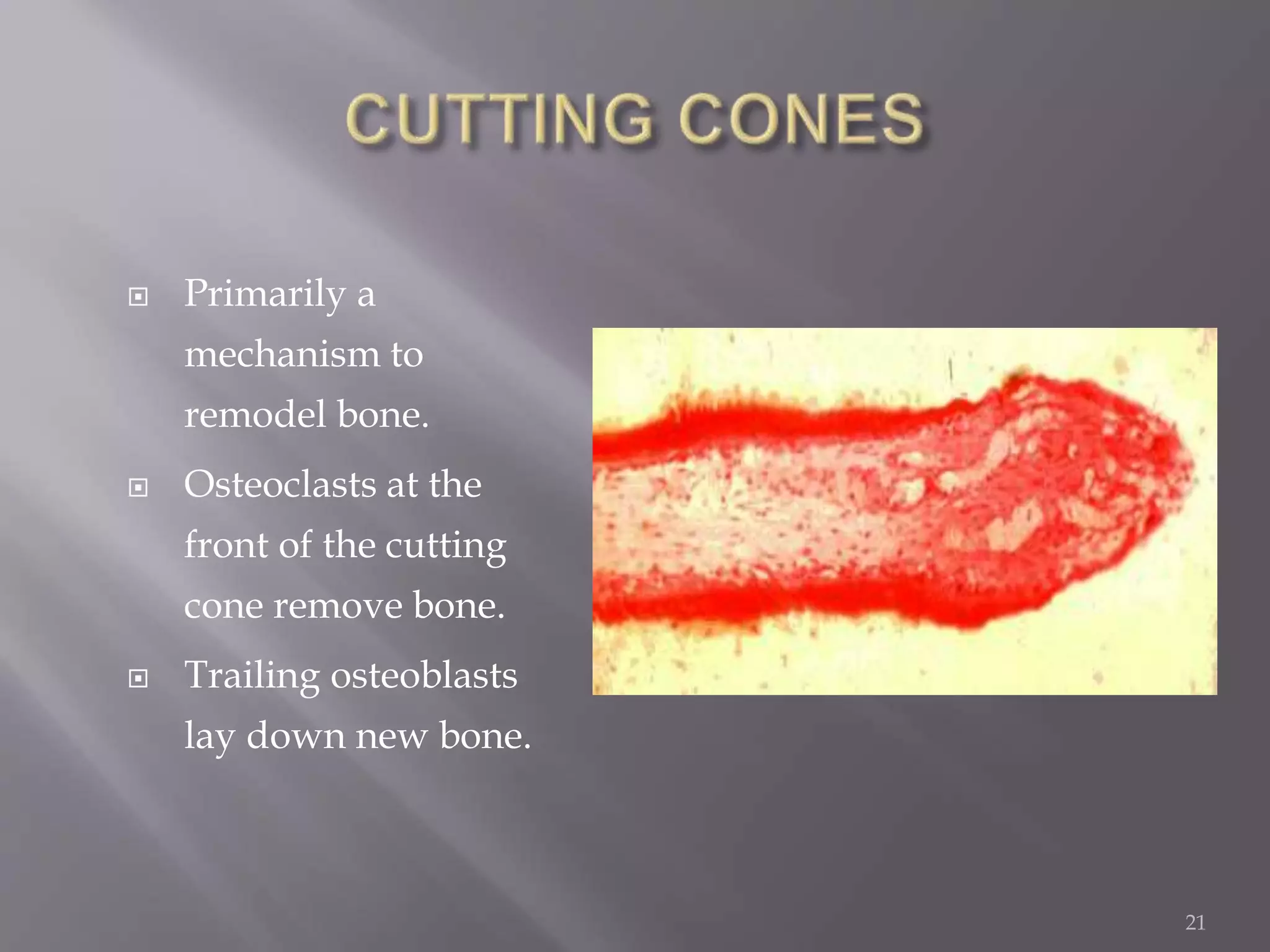 Pathophysiology of fracture healing | PPTX