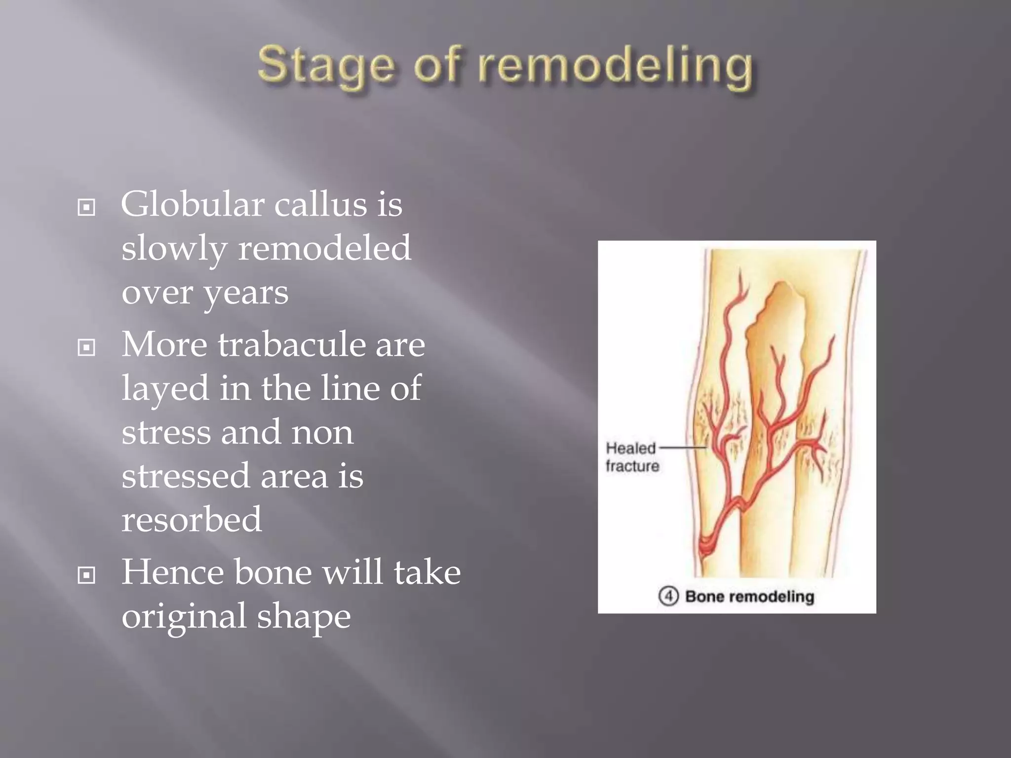 Pathophysiology of fracture healing | PPTX