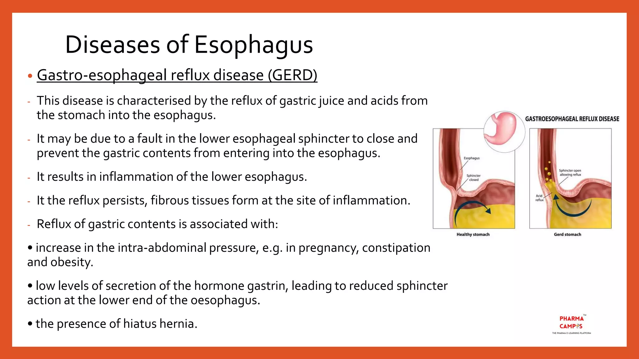 Pathophysiology of Gastrointestinal tract | PDF