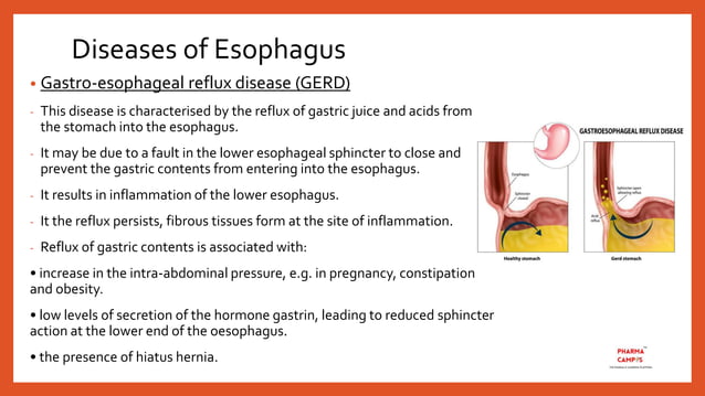 Pathophysiology of Gastrointestinal tract | PDF