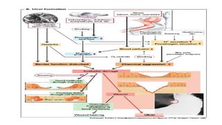 Pathophysiology of git disorder. | PPT
