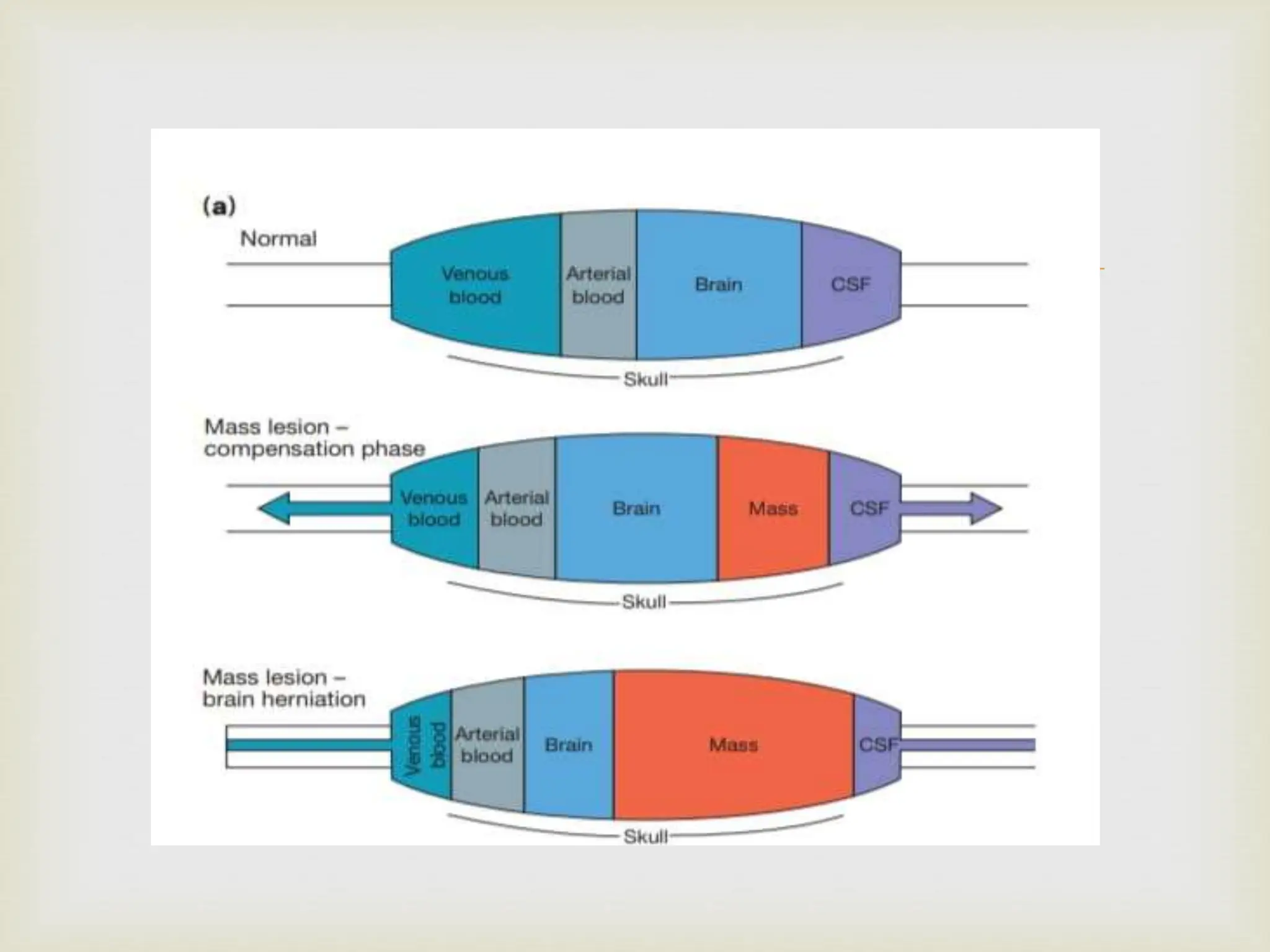 Patho physiology and mechanism of head injuries .pptx