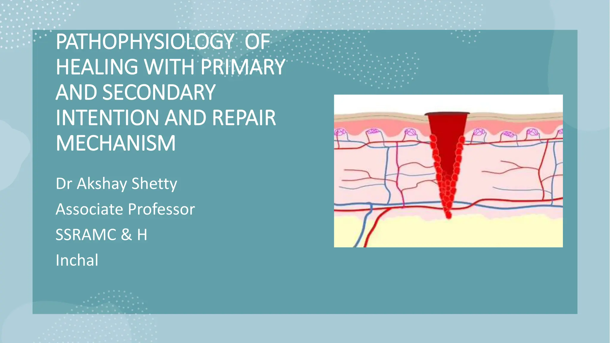 PATHOPHYSIOLOGY OF HEALING WITH PRIMARY & SECONDARY INTENTION.pptx
