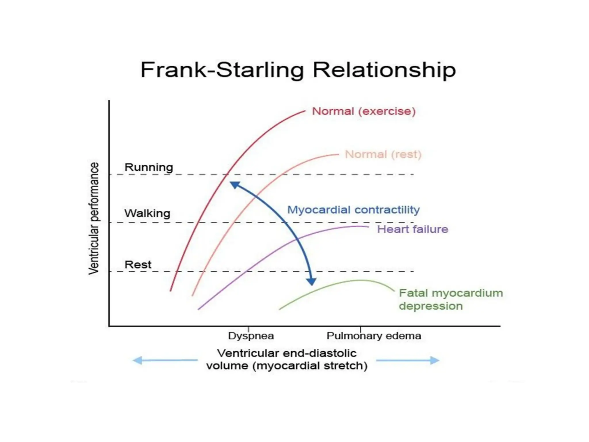 Pathophysiology of heart failure ......DR MERON.pptx