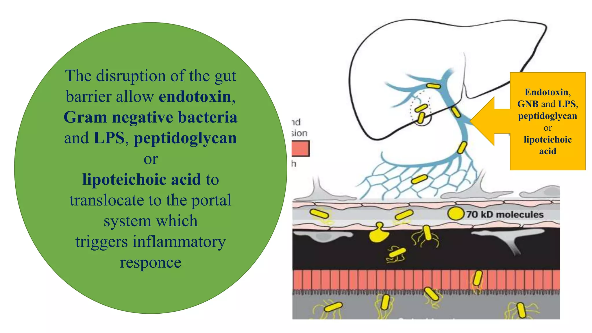 Pathophysiology of Hepatobiliary Menifestation of IBD.pptx