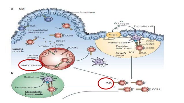 Pathophysiology of Hepatobiliary Menifestation of IBD.pptx