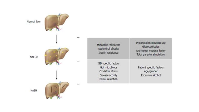 Pathophysiology of Hepatobiliary Menifestation of IBD.pptx