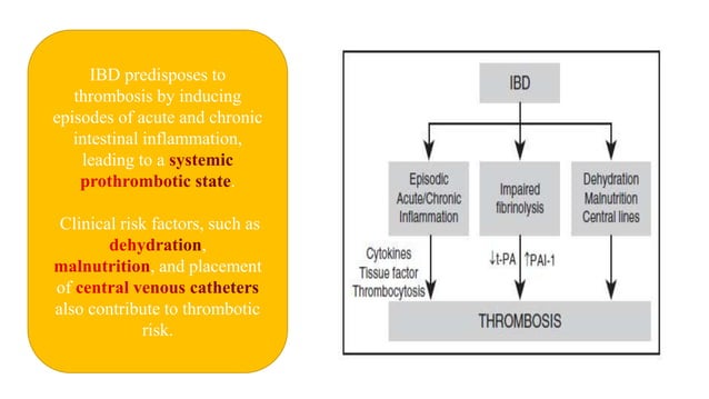 Pathophysiology of Hepatobiliary Menifestation of IBD.pptx