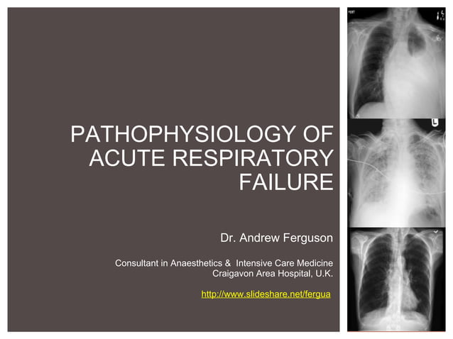 Pathophysiology of hypoxic respiratory failure | PPT
