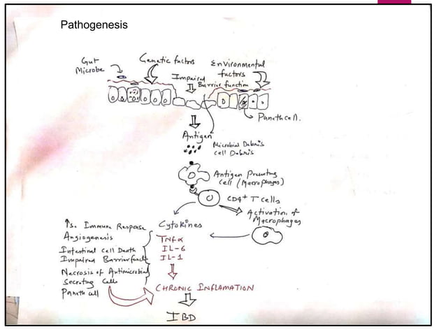 Pathophysiology of Inflammatory Bowel Disease (IBD) | PPTX | Digestive ...