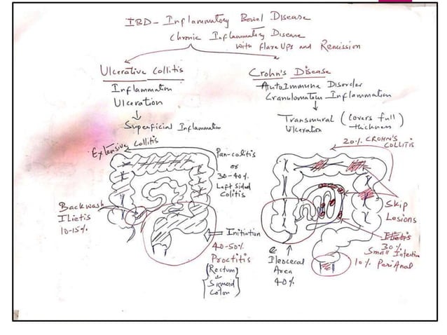 Pathophysiology of Inflammatory Bowel Disease (IBD)