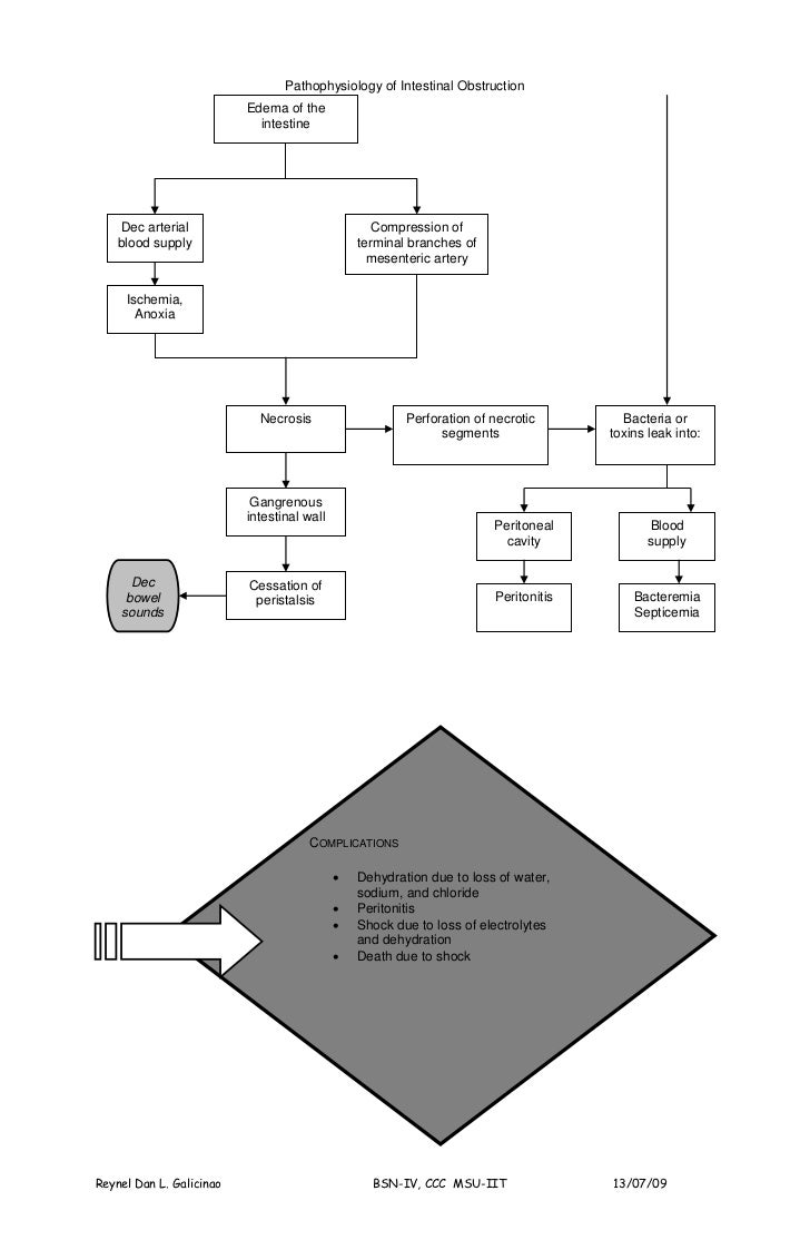 Schematic Diagram Of Pathophysiology Of Intestinal Obstructi