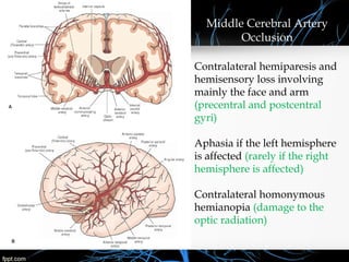 Basic Anatomy & Pathophysiology of ischemic stroke | PPT