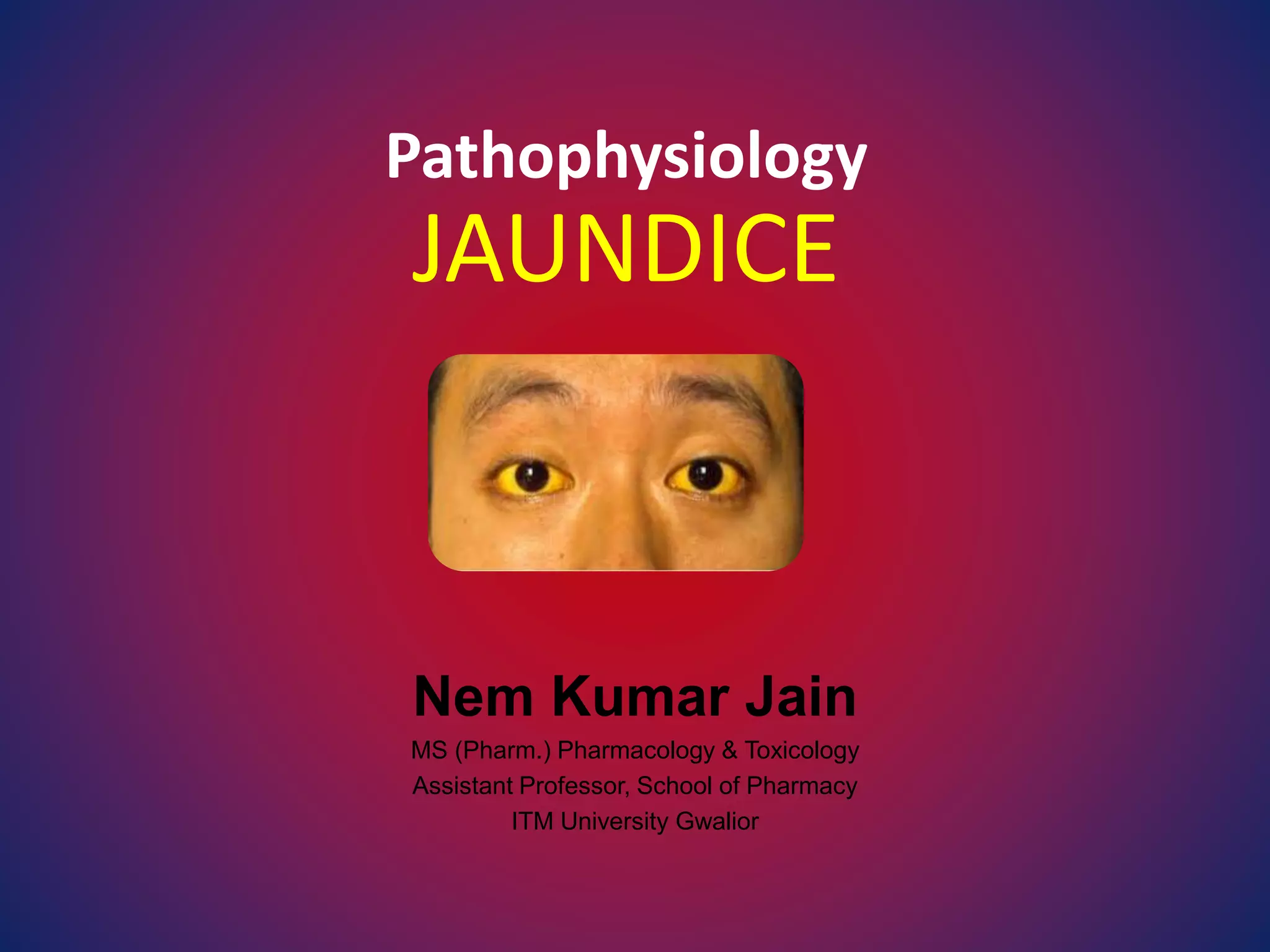 Pathophysiology of jaundice | PPTX
