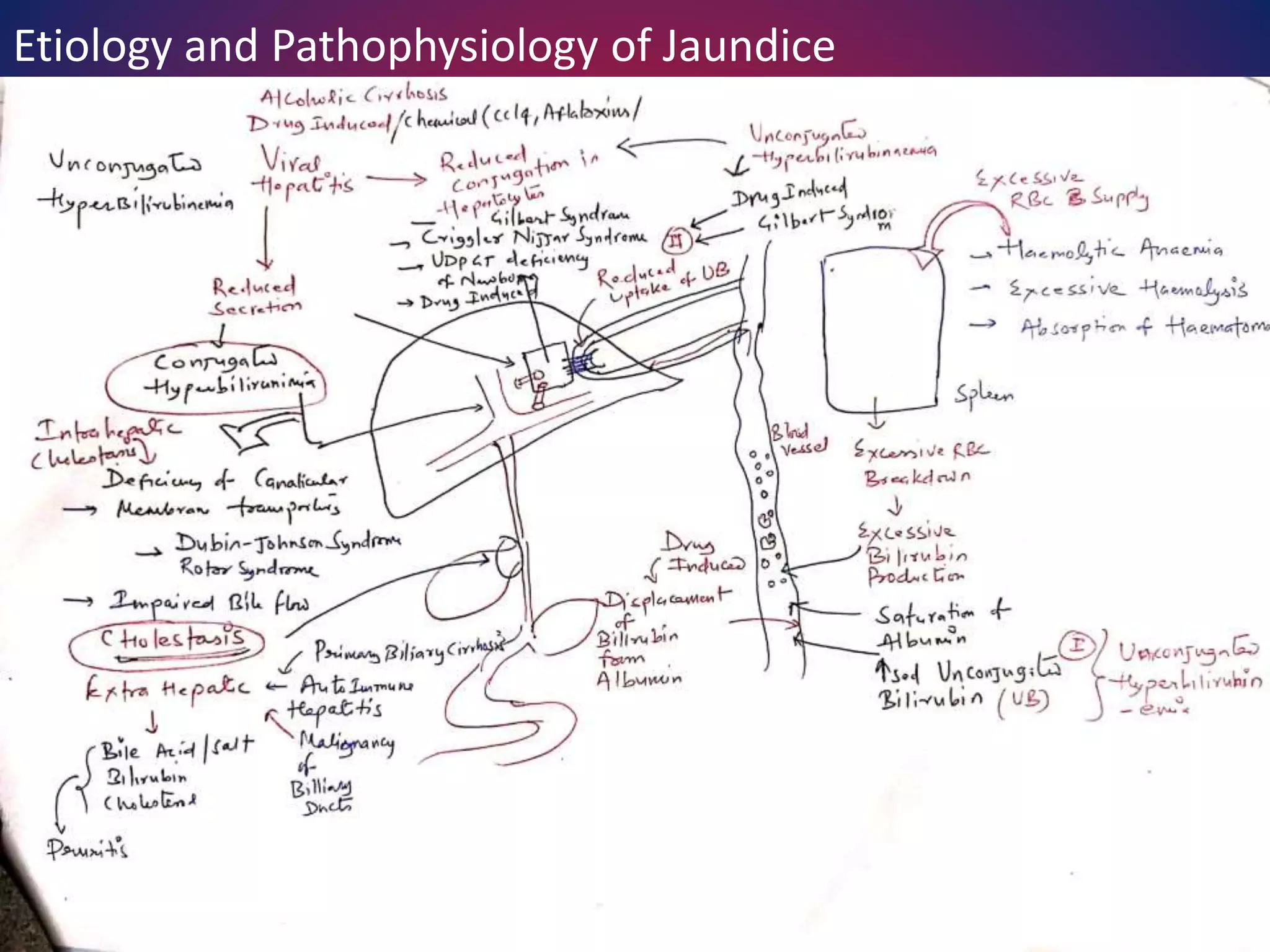 Pathophysiology of jaundice | PPTX
