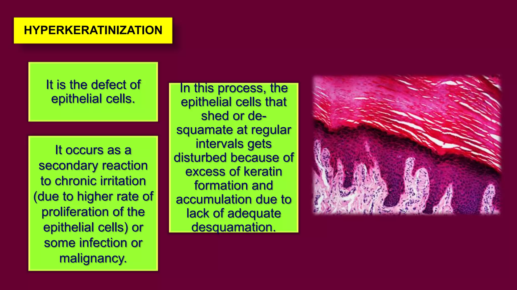Pathophysiology of keratinization | PPTX