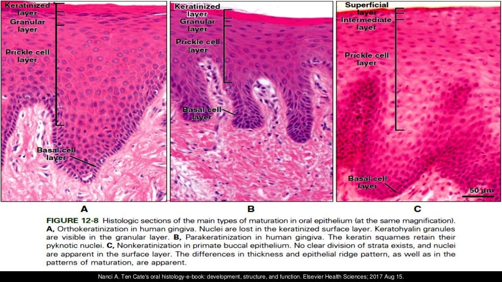 Pathophysiology of keratinization