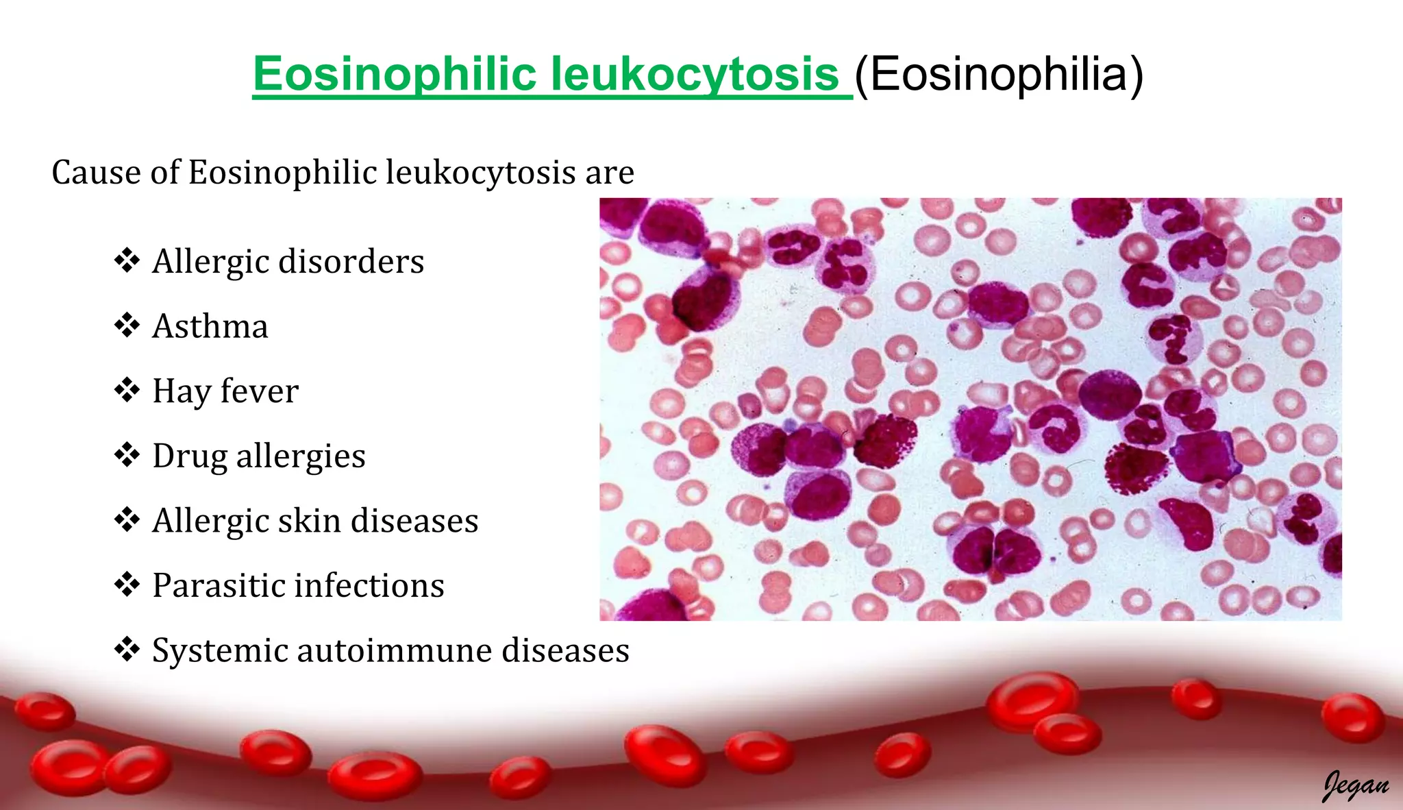 Pathophysiology of leukocytosis | PDF