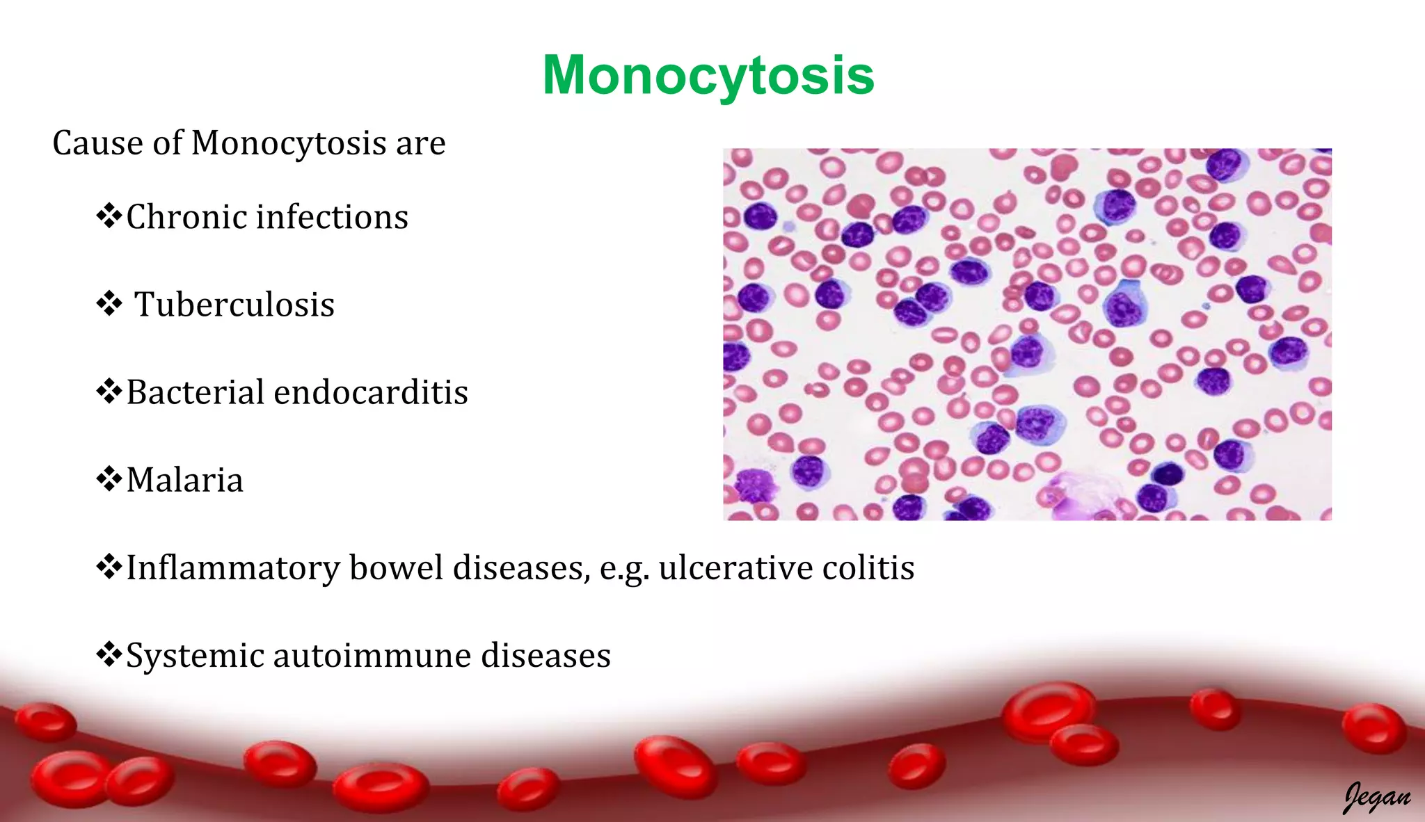 Pathophysiology of leukocytosis | PDF