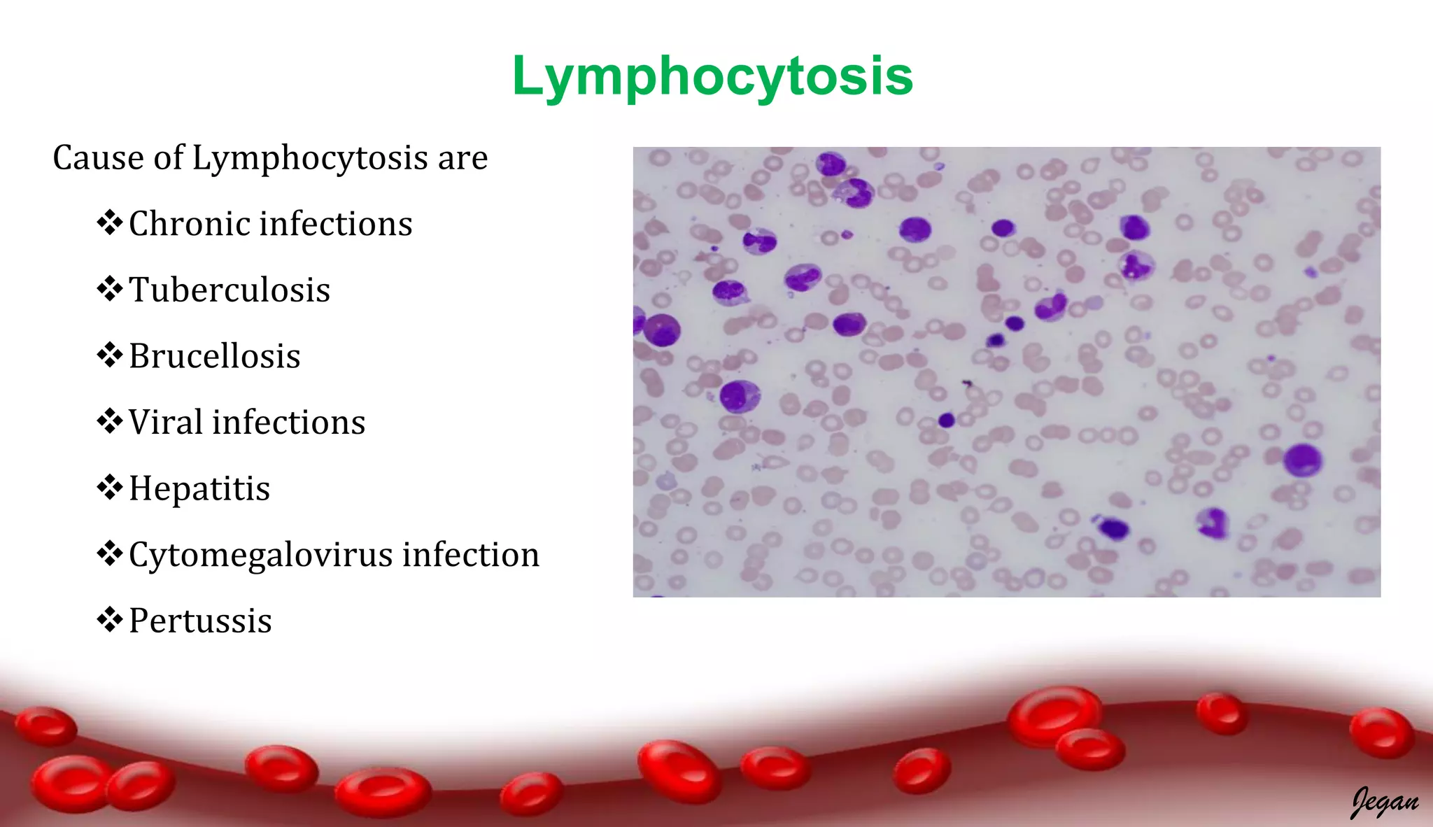 Pathophysiology of leukocytosis | PDF