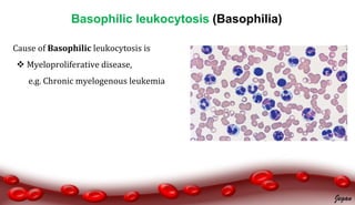 Pathophysiology of leukocytosis | PDF