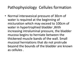 Pathophysiology of lower urinary tract obstruction.pptx