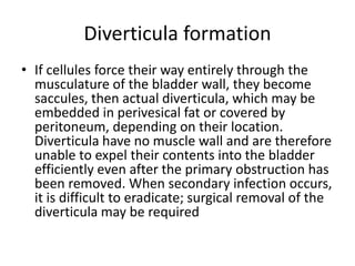 Pathophysiology of lower urinary tract obstruction.pptx