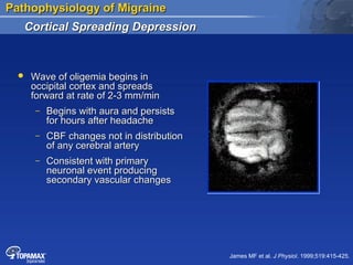 Pathophysiology of migraine | PPT