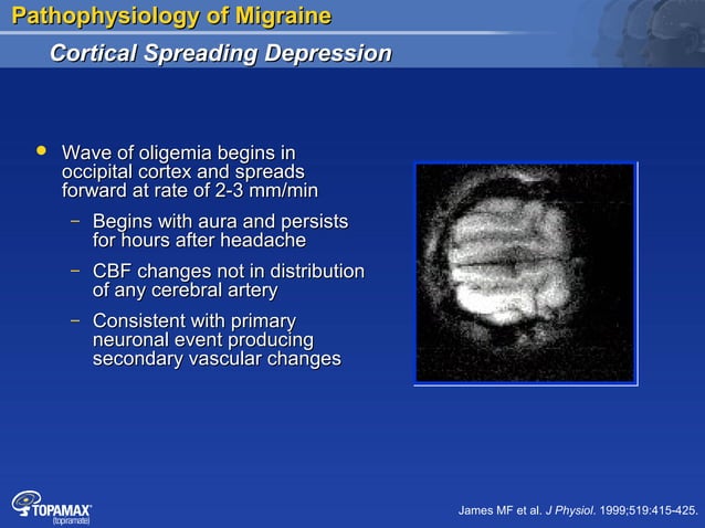 Pathophysiology of migraine | PPT