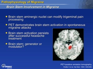 Pathophysiology of migraine | PPT
