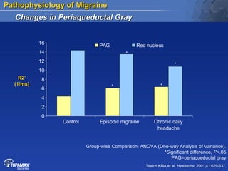 Pathophysiology of migraine | PPT