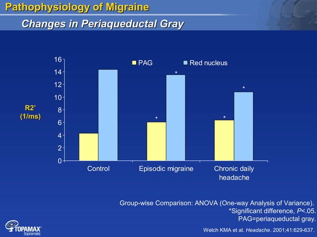 Migraine Pathophysiology Ppt | The pathophysiology of migraine ...
