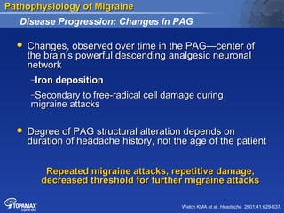 Pathophysiology of migraine | PPT