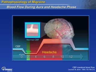Pathophysiology of migraine | PPT