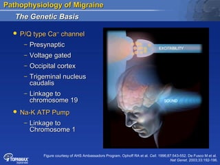 Pathophysiology of migraine | PPT
