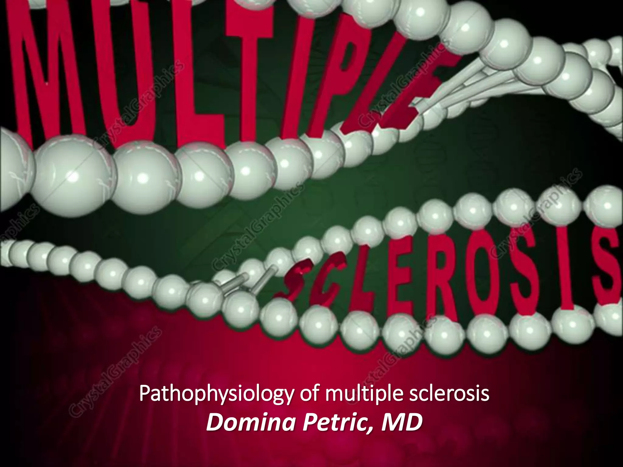 Pathophysiology of multiple sclerosis | PPSX